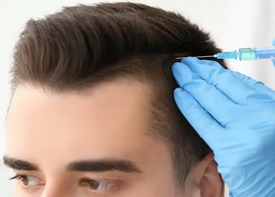 Platelet-Rich Plasma (PRP) Therapy In Turkey | Cayra Clinics