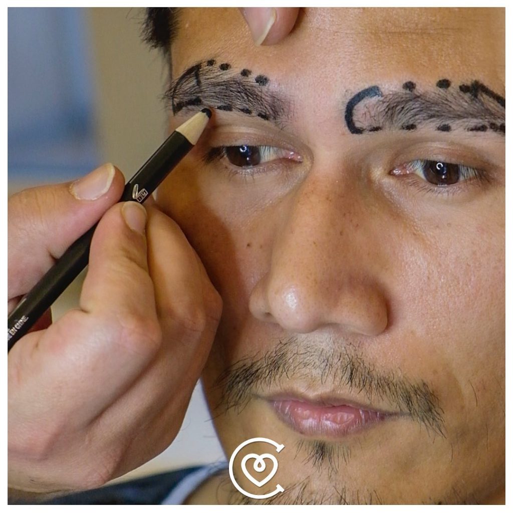 Eyebrow Transplant - Cayra Clinic